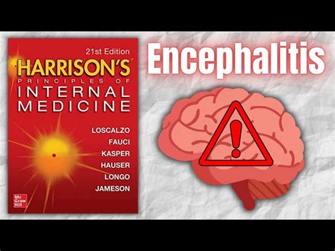 Free Video Encephalitis Etiology Clinical Features Diagnosis And