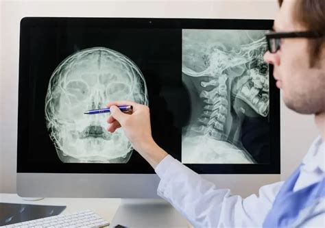 Sinusitis Maxilar De Origen Dental Una Infección De La Boca A La Nariz