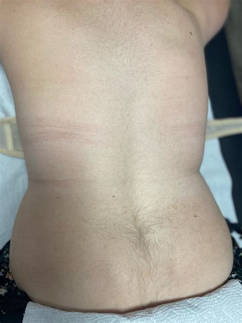 Female Lower Back Hair