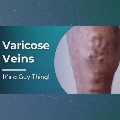 Varicose Veins And Insurance Coverage Insurance Cover Mental Health
