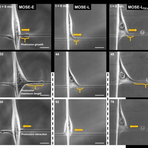 Protrusion Dynamics Show Significant Differences Across The Mose Model Download Scientific
