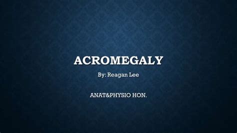 Gigantism Pptx Hormonal Disorders Endocrine And Metabolic Diseases