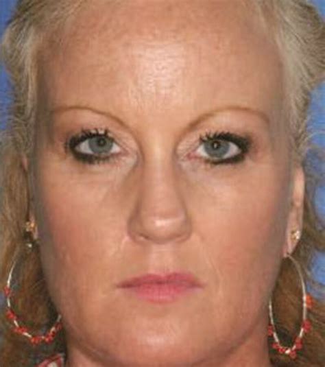 Photos Smokers Photographed Alongside Their Non Smoking Twins