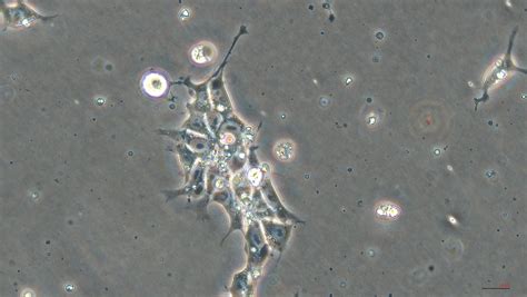 How To Deal With Bacterial Contamination In Ipsc Cultures Researchgate