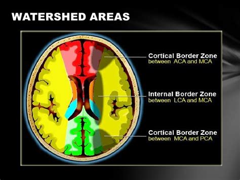 Watershed Zones Radiology At James Sumrall Blog