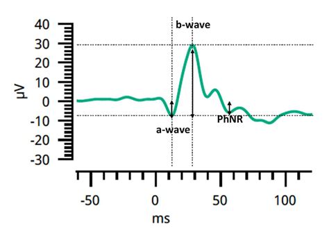 Retinal Variables Center For Retina And Brain Crab University Of