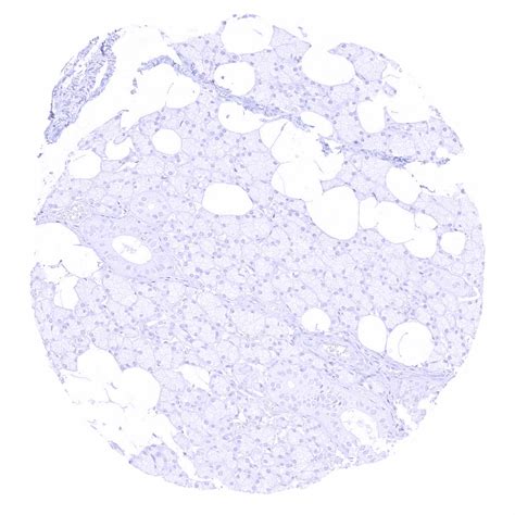 Normal Tissue Gallery Igd Ms Validated Antibodies