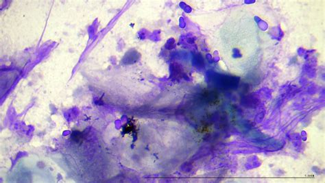 5 Topical Therapies To Minimize Systemic Antibiotic Use