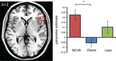 Significant Differences In Activation In Right Frontal Operculum X 54