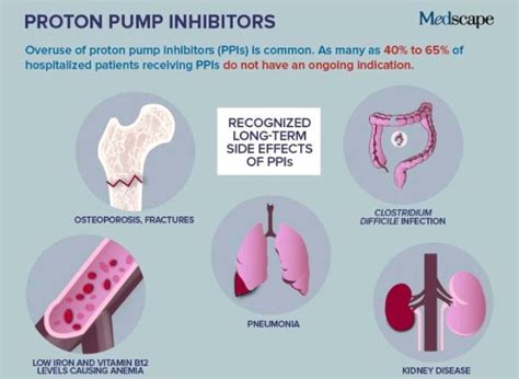 Ppi Stands For Proton Pump Inhibitors These Are Medications That