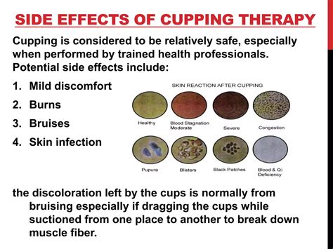 Cupping Therapy Pptx