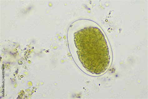 Poster Egg Of Hookworm In Human Stool Analyze By Microscope Original