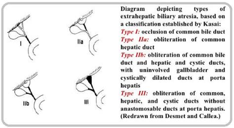 Normal And Biliary Atresia Download Scientific Diagram