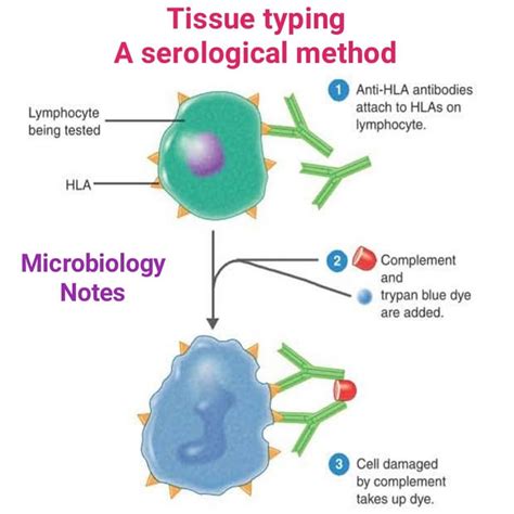 Tissue Typing A Serological Method Lymphocytes From The Person