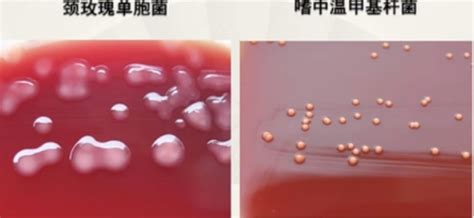 陈东科：微生物检验，别丢了形态学基本功形态学微生物检验细菌菌落涂片荚膜芽胞阴性 健康界