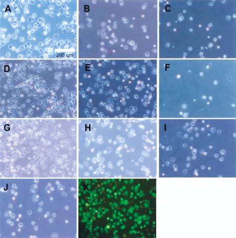 The Phase Contrast Photomicrographs Of Human Hepatocytes Before A And Download Scientific