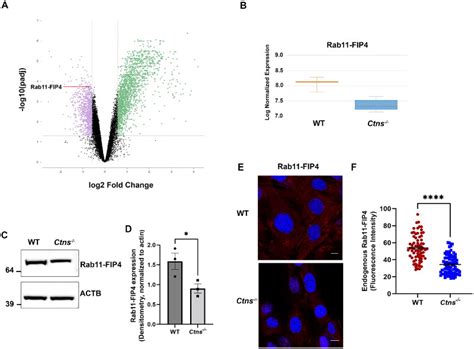 Reconstitution Of Rab11 Fip4 Expression Rescues Cellular Homeostasis In Cystinosis Pmc