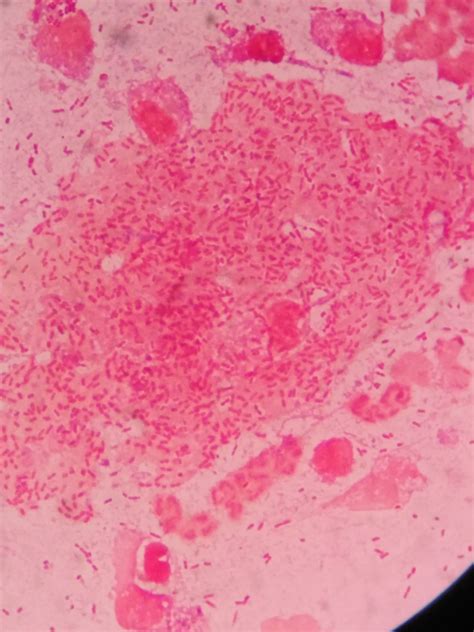 Proteus Vulgaris Gram Stain 1000x