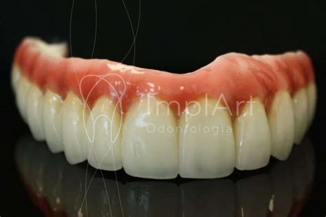 Fixed Dental Prosthesis Specialist Clinic Implart
