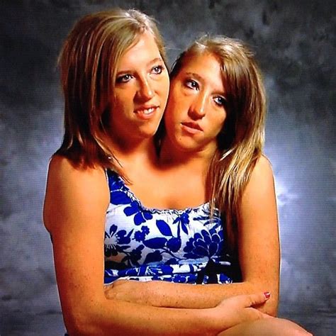 These Really Unusual People Will Make Even You Feel Normal Conjoined