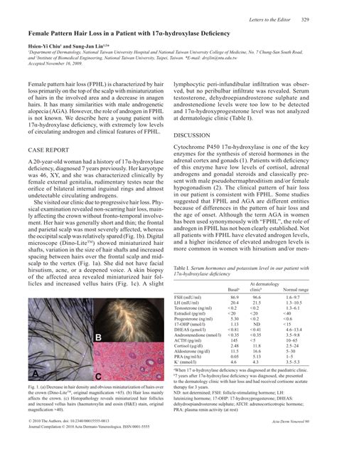 Pdf Female Pattern Hair Loss In A Patient With 17 Alpha Hydroxylase