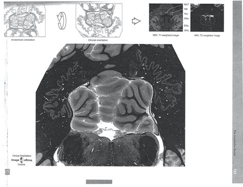 6 17 Brain Slice Cerebellum Diagram Quizlet