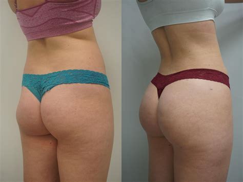 Brazilian Butt Workout Results