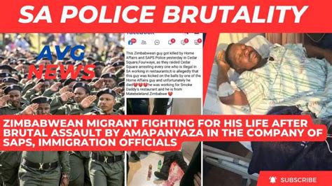 Left For Dead Zimbabwean Man Relieves Ordeal In The Hands Of The