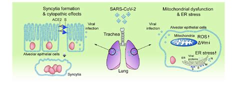 Schematic Representation Of The Lung Damage Induced By Sars Cov 2