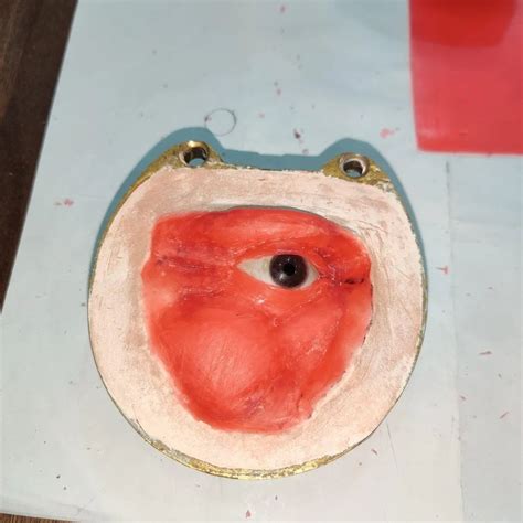 Eye Silicone Orbital Prosthesis Facial At ₹ 45000 In Lucknow Id