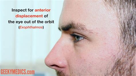 Thyroid Status Examination Osce Guide Geeky Medics