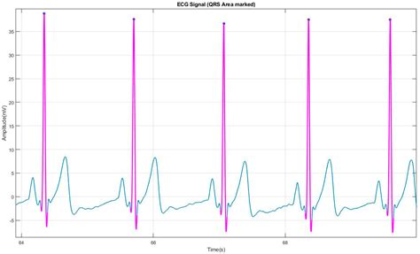 Applied Sciences Free Full Text Reservoir Computing Based Echo