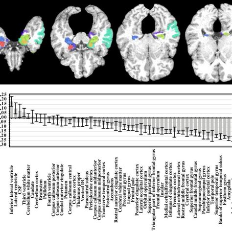 A Using A Svm Multi Kernel Approach Zhang Et Al Zhang Et Al 2011 Download Scientific