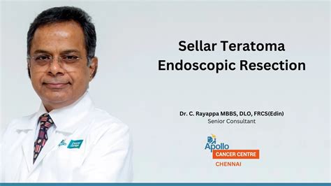 Sellar Teratoma Head Neck And Skullbase Surgery Chennai