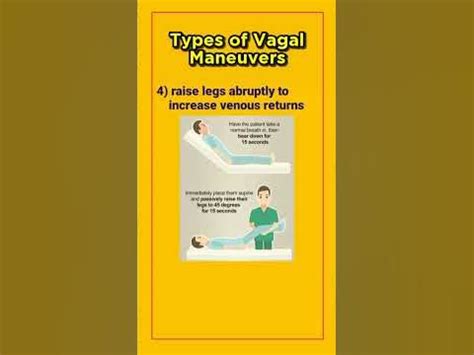 Vagal Maneuvers The Ultimate Guide Vagal Maneuvers For Svt Shorts