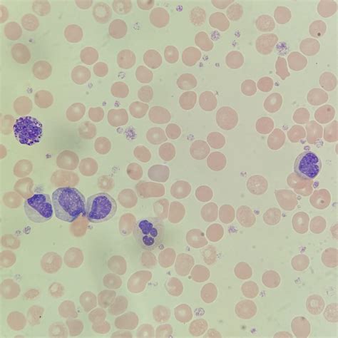 Practice Differentials Medlabbuddy