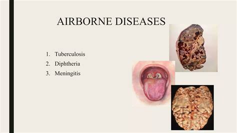 Airborne Diseases Ppt