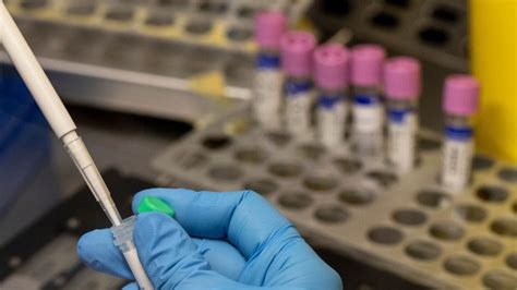 Understanding Monkeypox Symptoms Transmission And Management News18