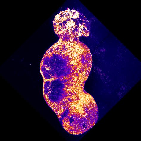 Pasca Lab At Stanford Medicine Pasca Lab