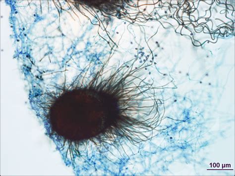 Chaetomium Spp Institut National De Santé Publique Du Québec