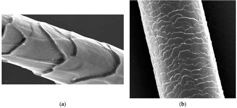 Known And Unknown Features Of Hair Cuticle Structure A Brief Review