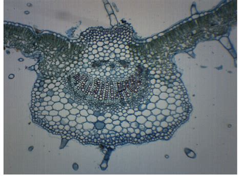 Syringa Vulgaris Leaf Prepared Microscope Slide 75x25mm Klm Bio