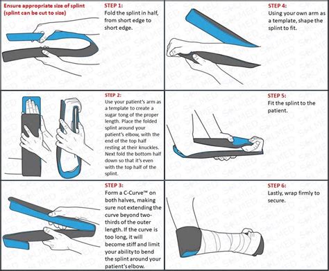 Aluminium Foam Splint Rolled Small Solmed Solmed Medical Supplies