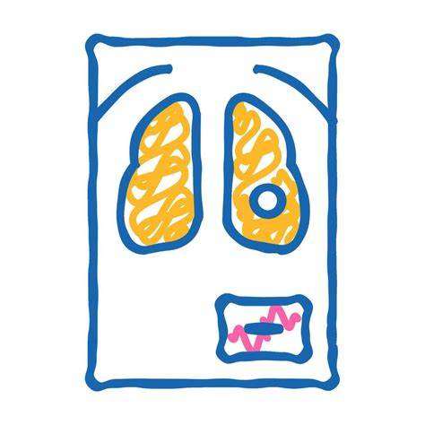 Fluorography Snapshot Sign Icon Doodle Illustration 49831176 Vector Art