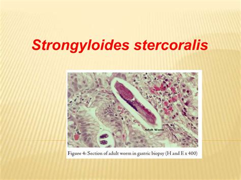 Powerpoint Strongyloides Stercoralisppt