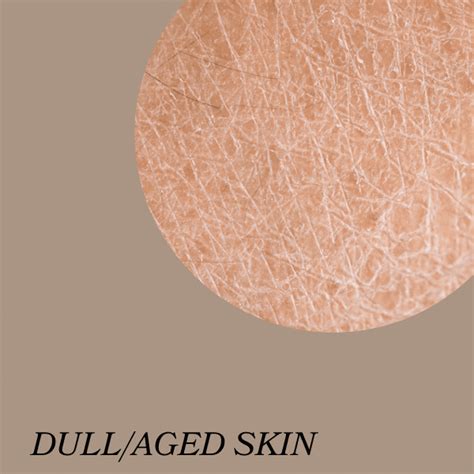 Profractional Laser Resurfacing Salt Lake City Ut