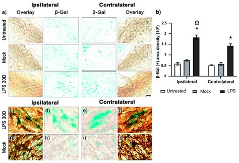Lps Induces Senescence In Dopaminergic Neurons Of The Snpc A