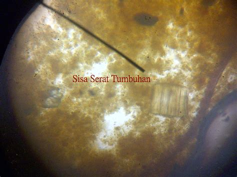 Rizqi Murtafi Ah Pemeriksaan Feses Lengkap