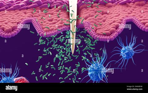 Illustration Showing Bacteria Green Entering The Body Through A