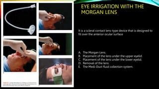 Eye Drop Or Ointment Placement Ocular Ntact Lenspptx